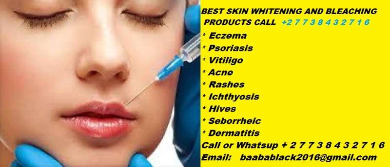 Skin Bleaching , Skin Lightening And Skin Whitening Products ...